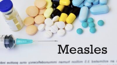 What does measles look like? - NowPatient